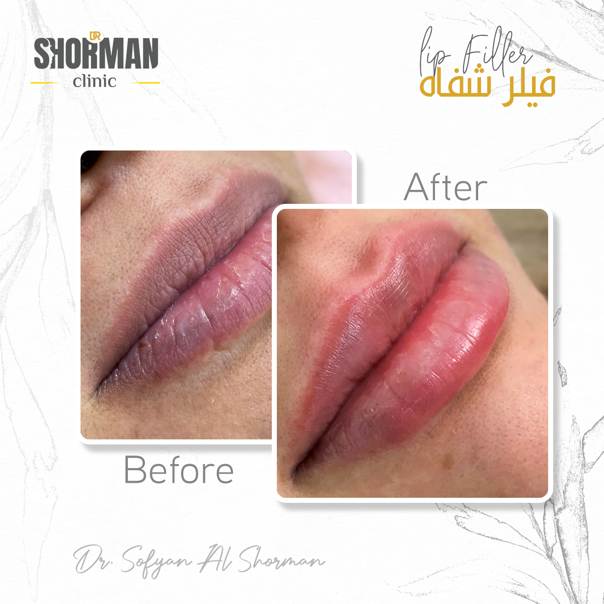 Dr. Sofyan AlShorman